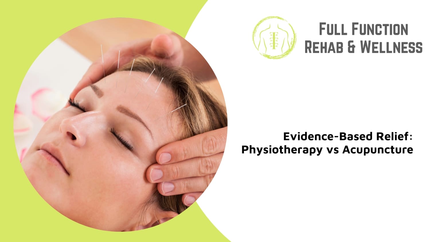 Evidence-Based Relief: Physiotherapy vs Acupuncture